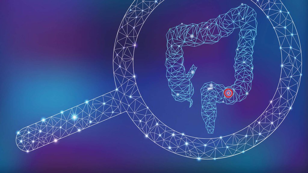 My Colon - Non-invasive screening test for colorectal cancer