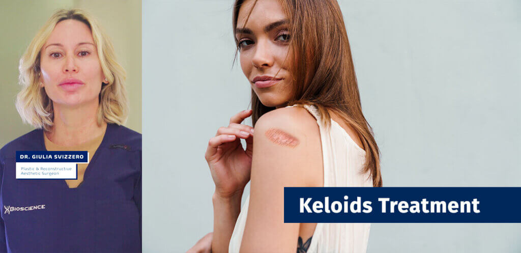 Keloids - Bioscience Institute